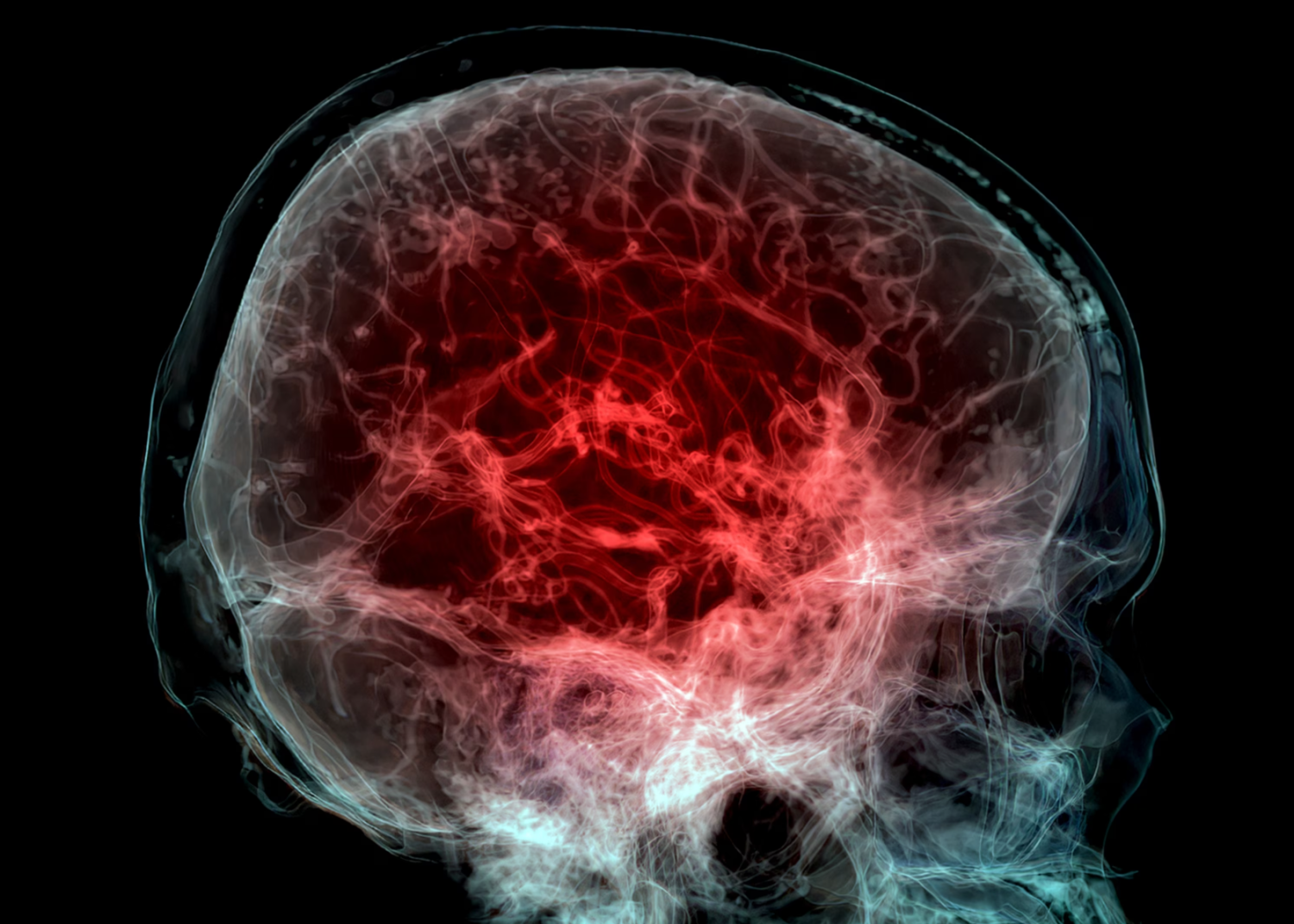 Unsettling levels of microplastics discovered in human brains