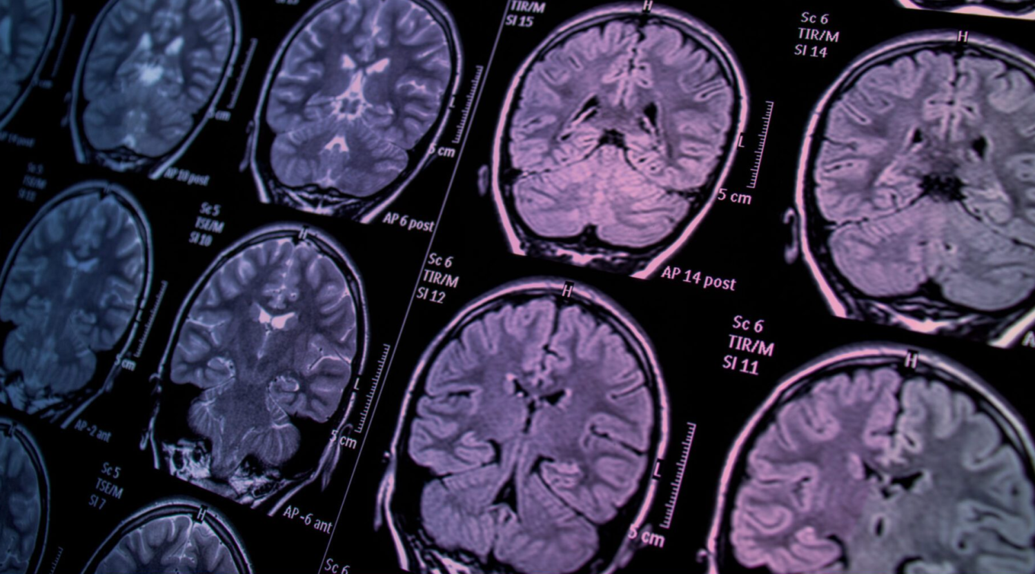 Meta invents device that replaces a keyboard for typing with thoughts