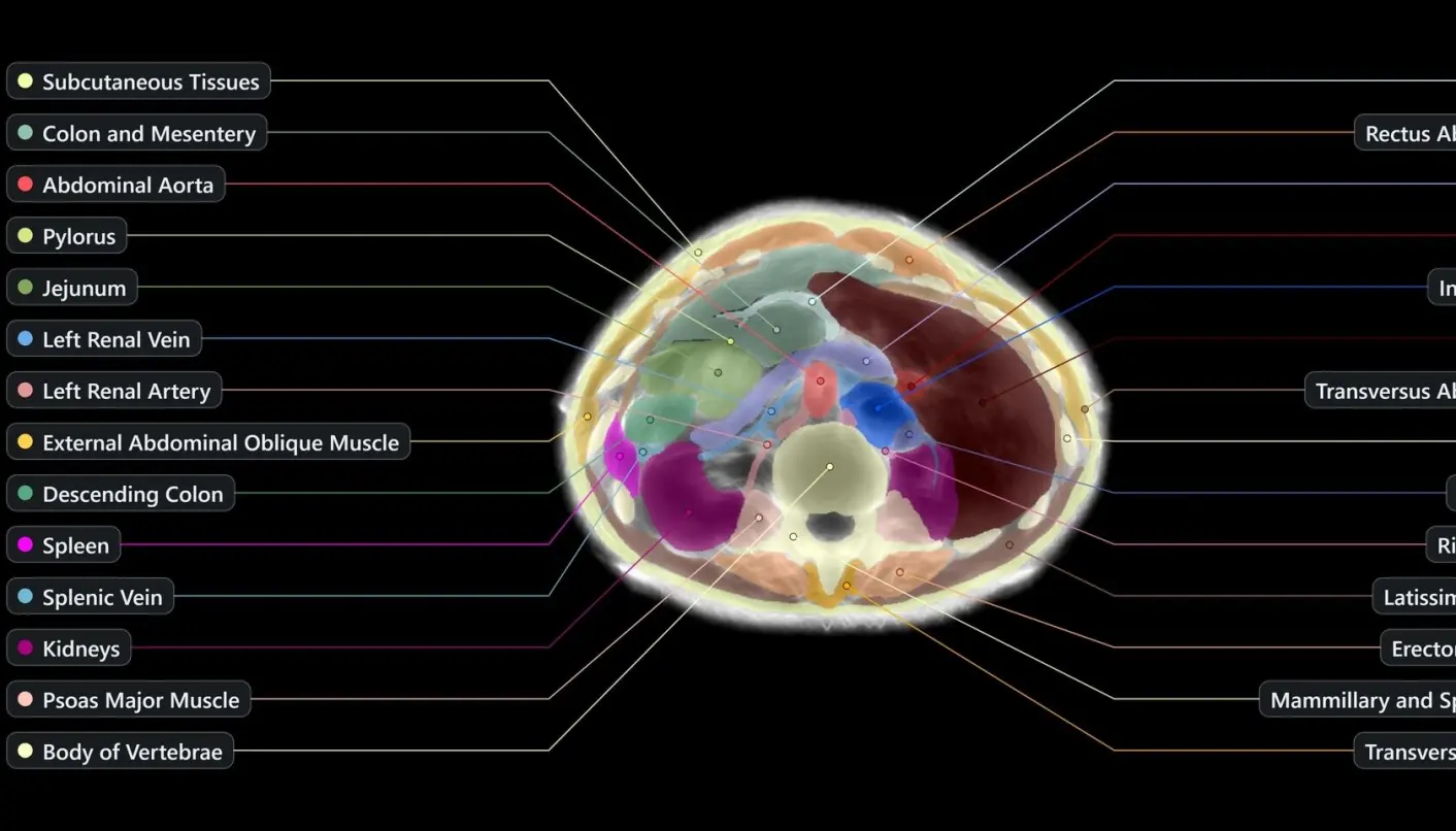 Midjourney is stepping away from AI art to build a full-body ultrasound ...