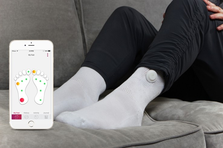 So... 'smart socks' are now an actual thing
