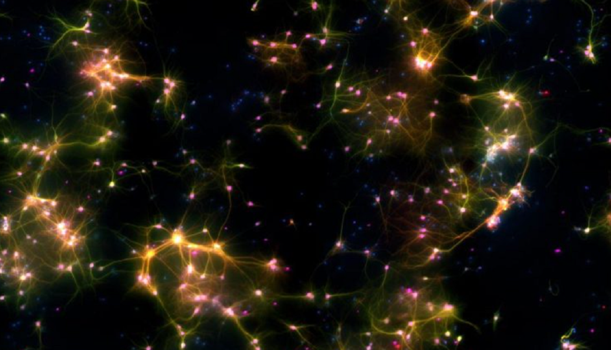 800 000 Living Brain Cells Successfully Taught To Play A Video Game