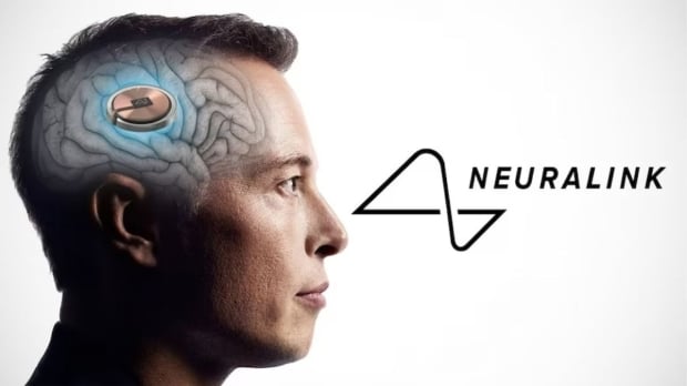 Neuralink confirms its first human brain chip patient experienced a ...